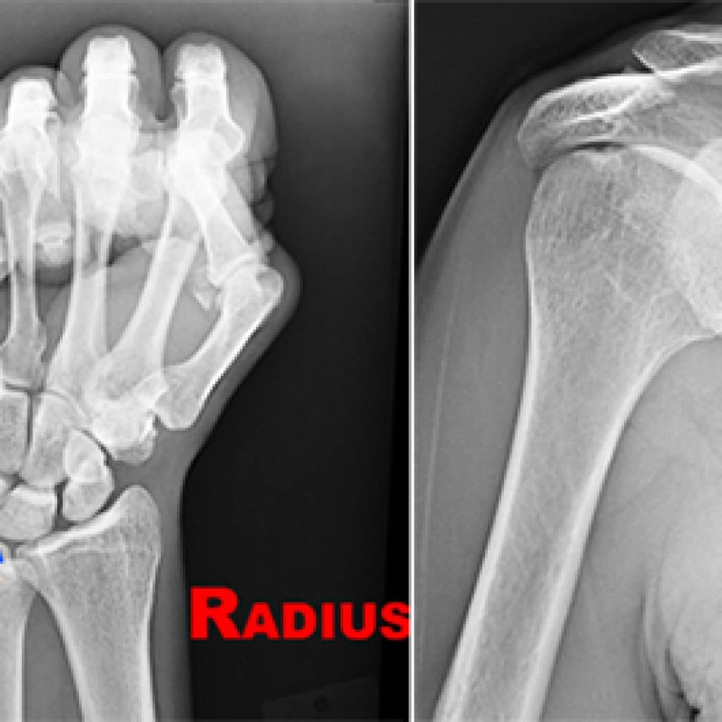The Most Important Bones in Tennis - TennisPlayer